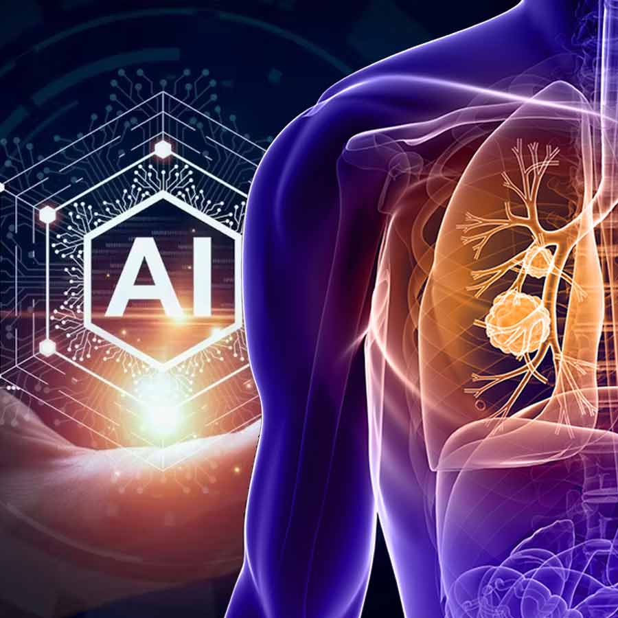 AI Technique for Lung Cancer | The new AI feature spots lung cancer symptoms and help in early ...