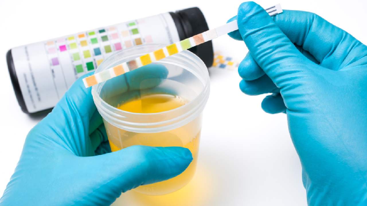 Urine Test Precaution | Tips women should keep in mind while giving ...