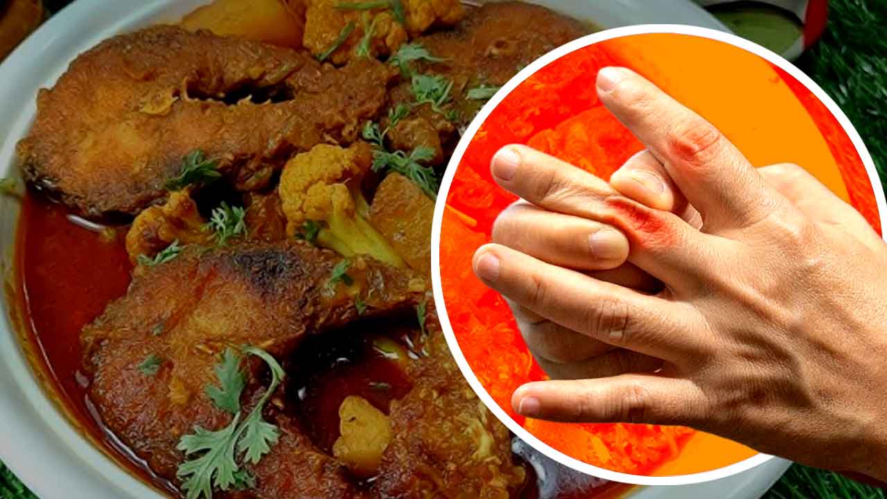 Diet Tips for Gout Problem | Is eating Ruhu and Katla fish can cause ...