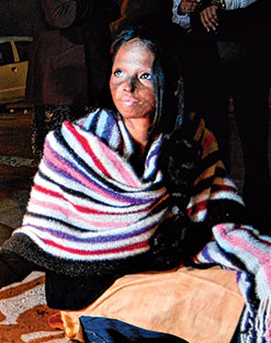 Acid victim to fashion model - Telegraph India