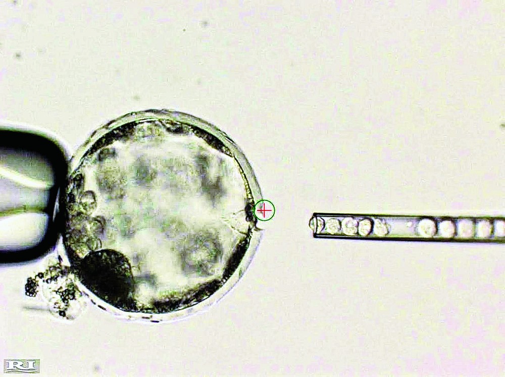 Transplant promise in mixed embryo - Telegraph India